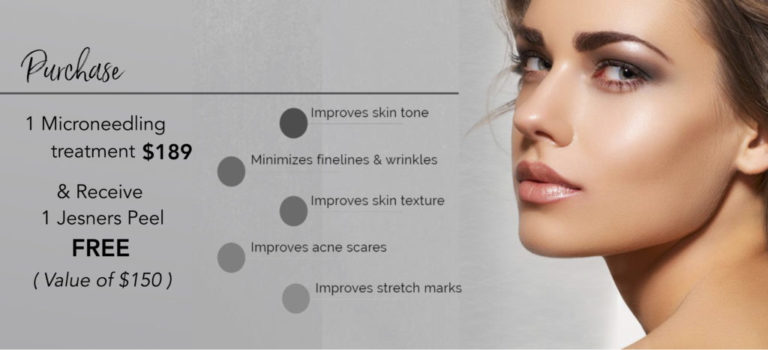 Promo_Microneedling.jpg | Kawartha Cosmetic Clinic